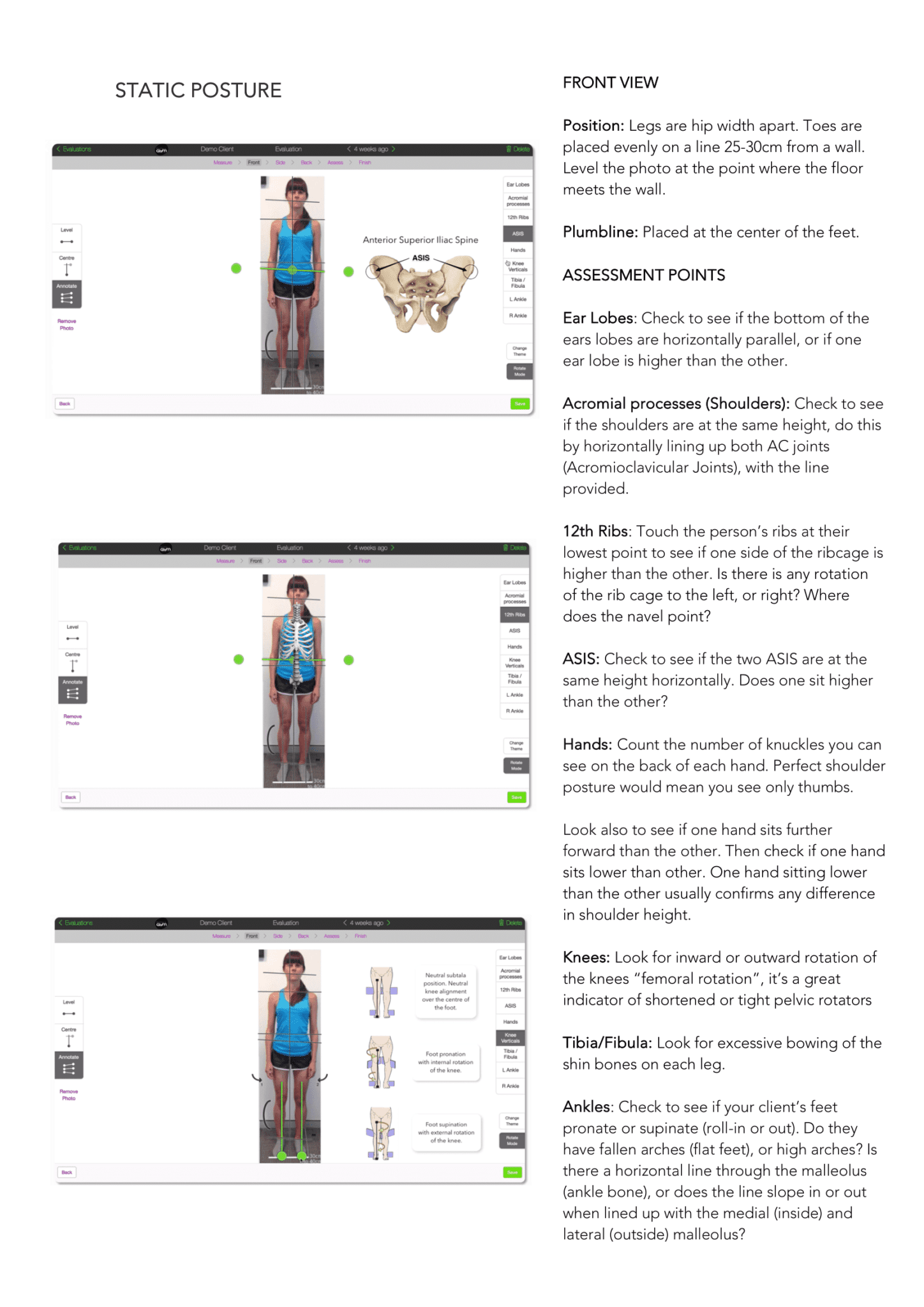 Static Postural Evaluations Using Goxpro