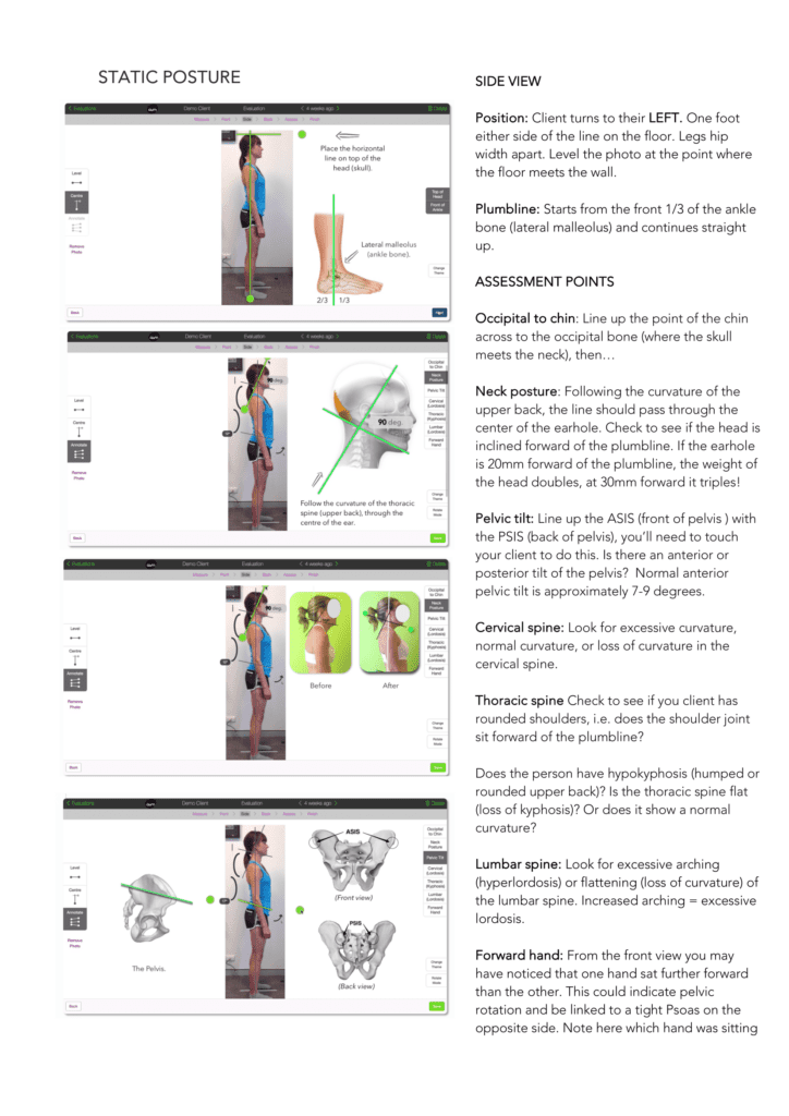 Static postural evaluations using GoXPro